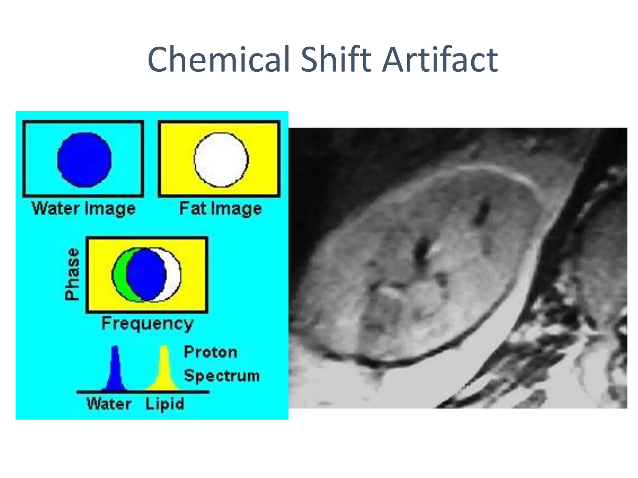 Mri Artifacts Introduction Classification Types Ppt