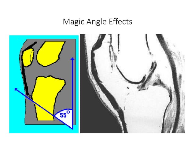 MRI Artifacts (introduction, classification, types) | PPT