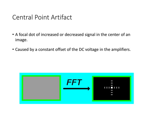 MRI Artifacts (introduction, classification, types) | PPT
