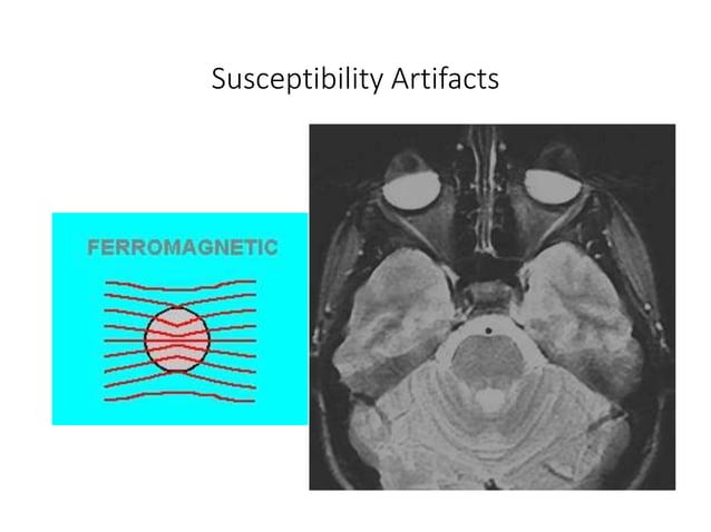 MRI Artifacts (introduction, classification, types) | PPT