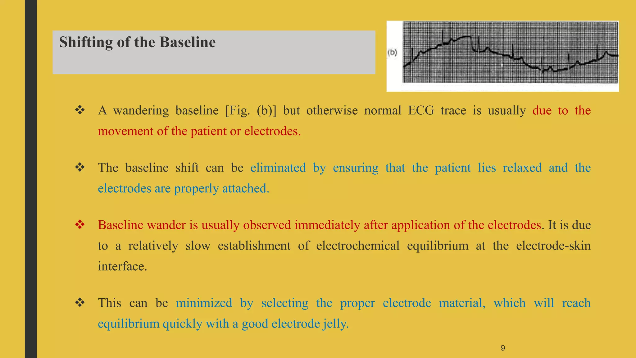 ARTIFACTS ON ECG RECORDING | PDF