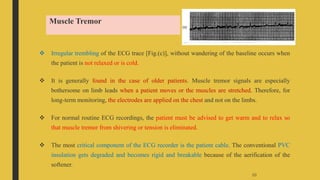 ARTIFACTS ON ECG RECORDING | PDF