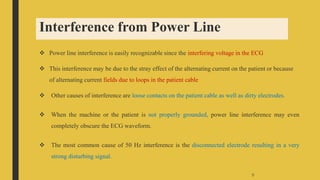 ARTIFACTS ON ECG RECORDING | PDF