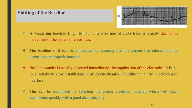 ARTIFACTS ON ECG RECORDING | PDF