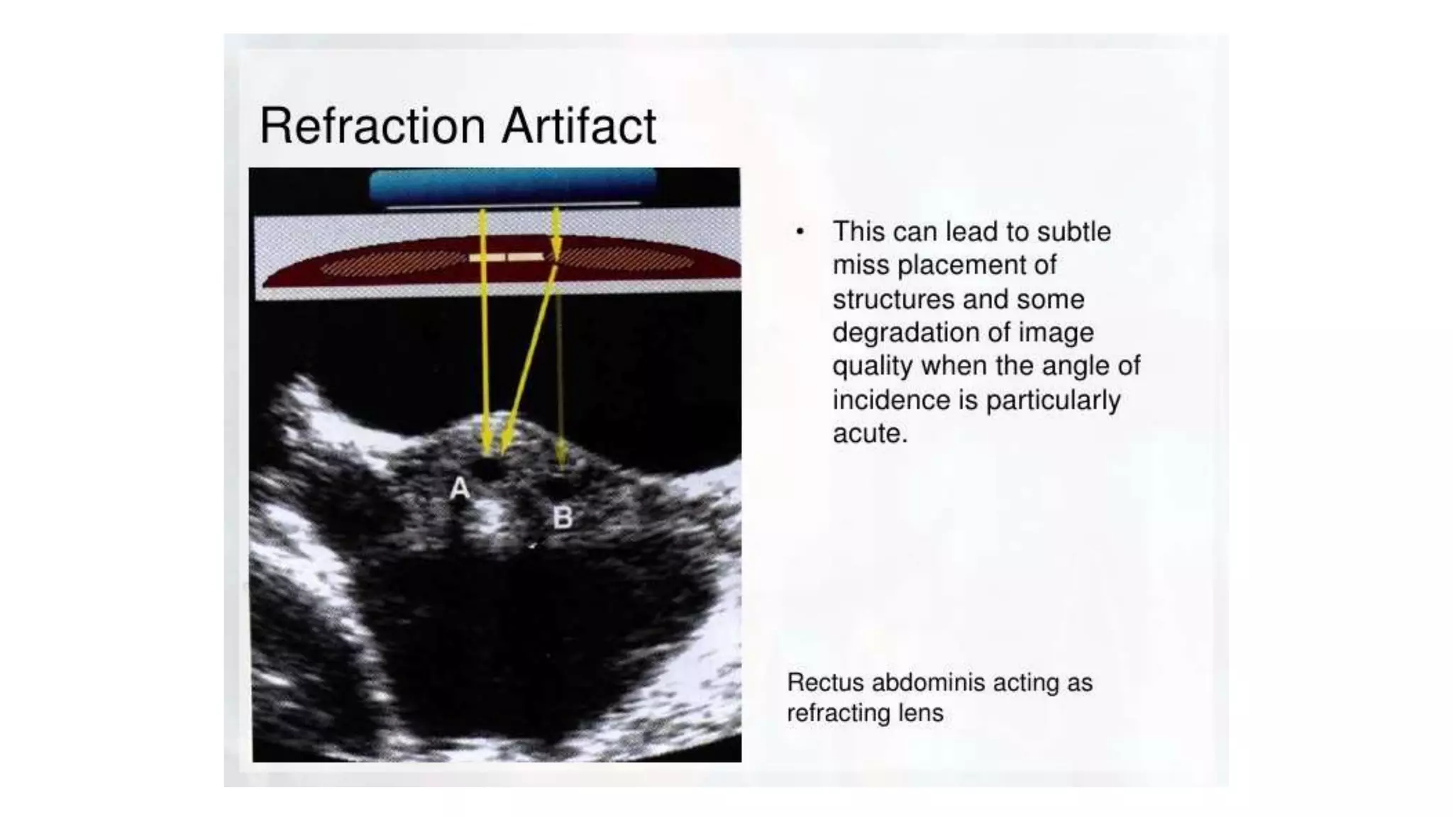 Artifacts usg, ct, mri radiology ppt,pdf pk | PPTX
