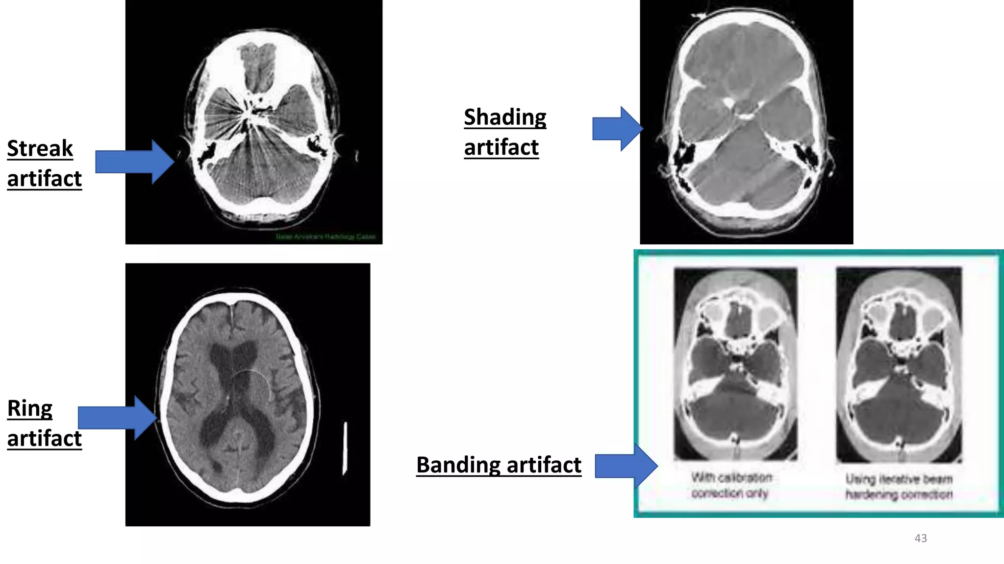 Artifacts usg, ct, mri radiology ppt,pdf pk | PPTX