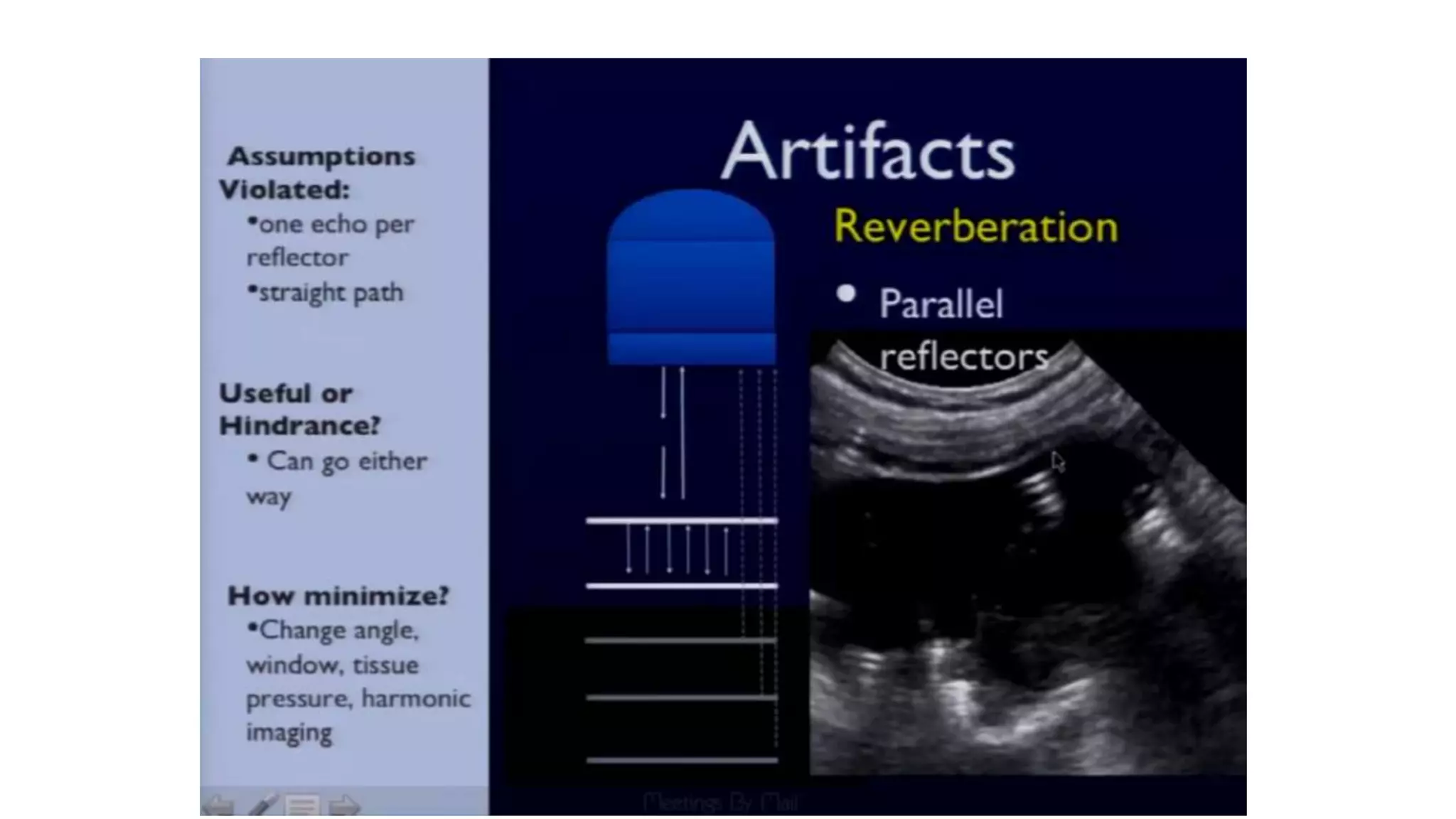 Artifacts usg, ct, mri radiology ppt,pdf pk | PPTX
