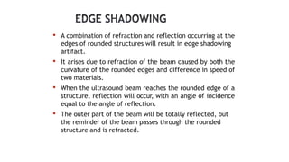 Artifacts usg, ct, mri radiology ppt,pdf pk | PPTX