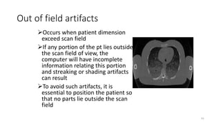 Artifacts usg, ct, mri radiology ppt,pdf pk | PPTX