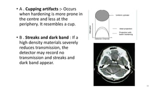 Artifacts usg, ct, mri radiology ppt,pdf pk | PPT