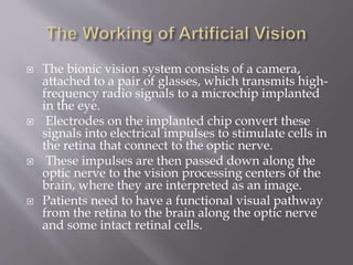 Artifcial Eye | PPTX