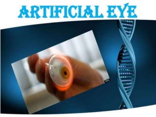 Artifical eye | PPT