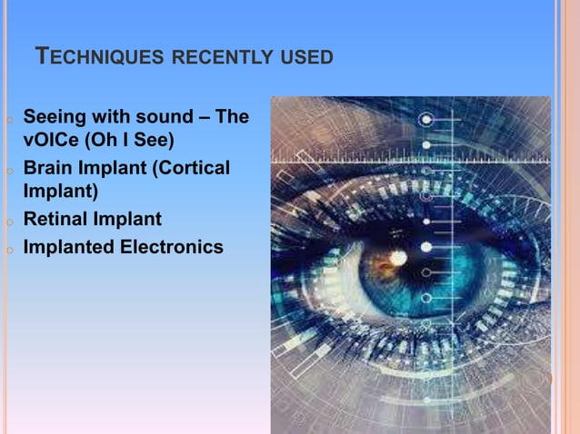 Artifical eye | PPT