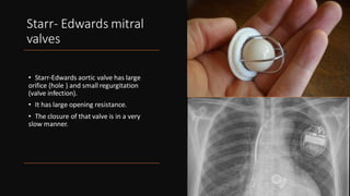 artifical heart valve | PDF