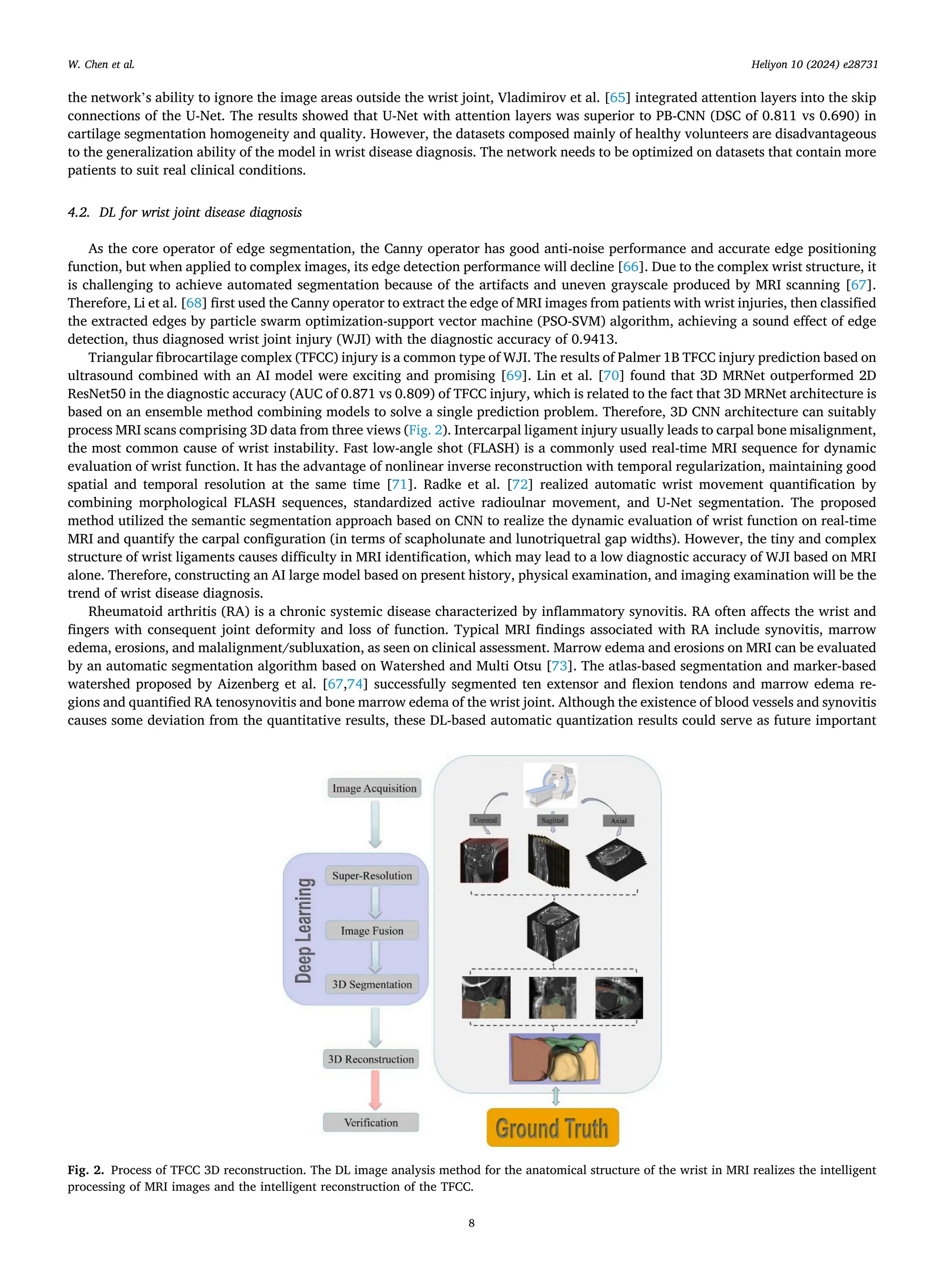 Artificial-intelligence-powered-advancements-in-upper-extremity-j_2024_Heliy.pdf