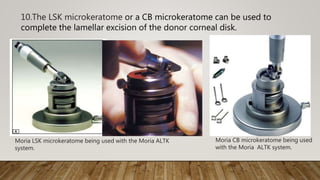 Artificial anterior chamber | PPTX