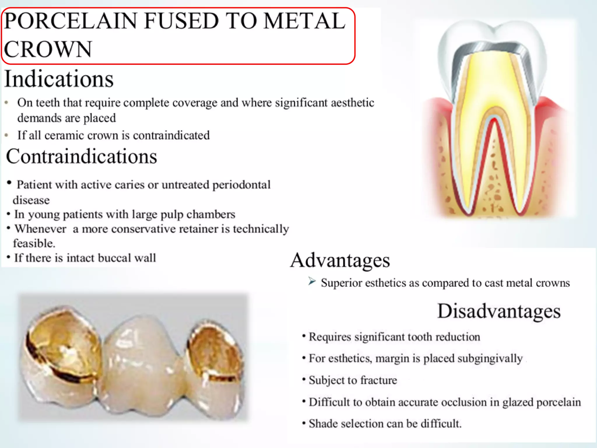 Artificial crowns. Temporary crowns..pdf