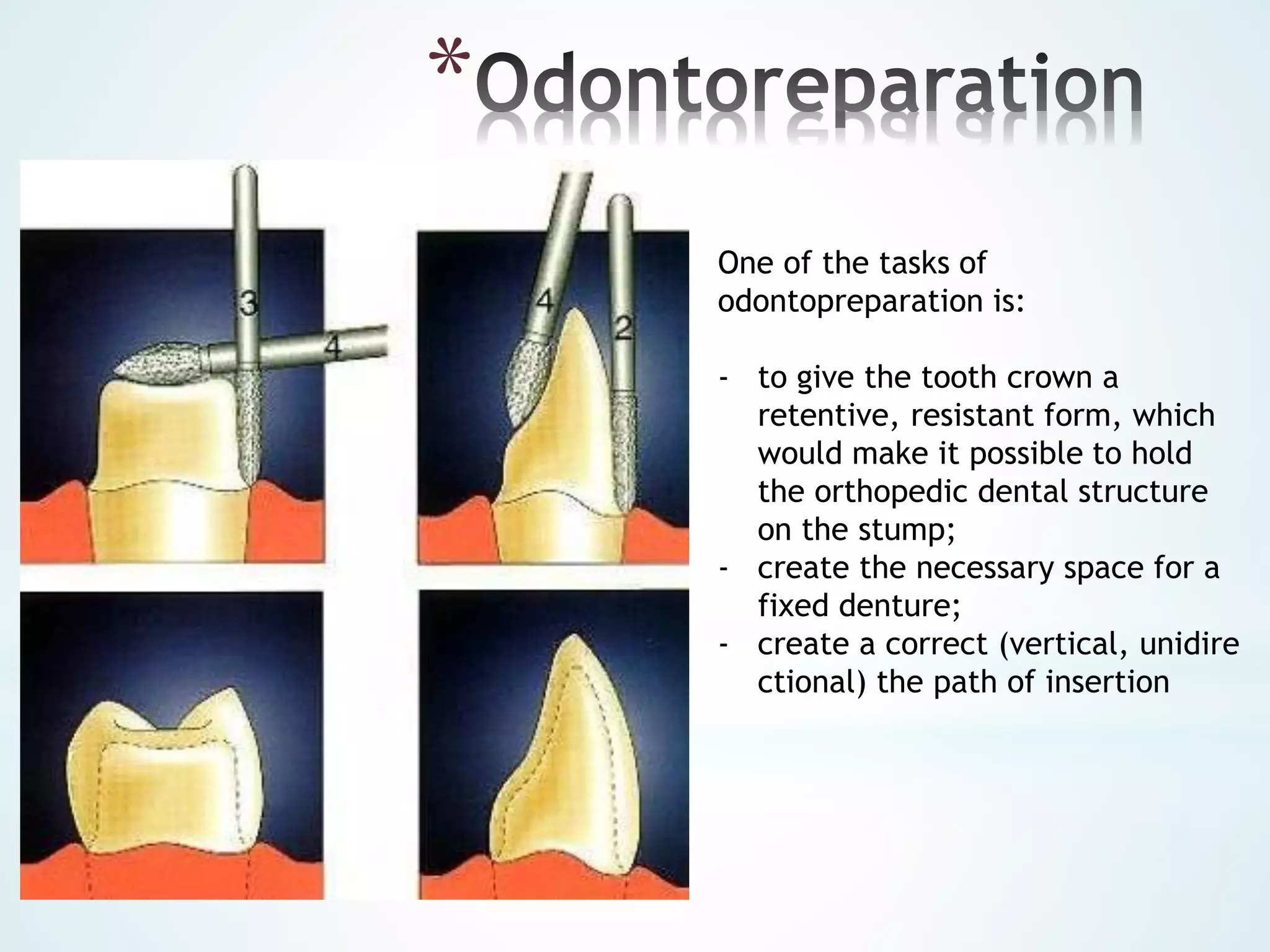 Artificial crowns. Temporary crowns..pdf