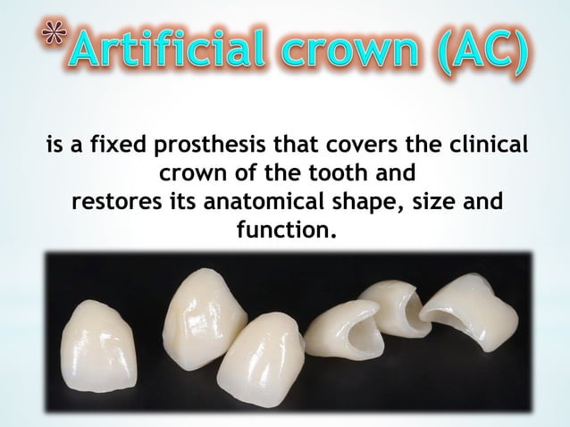 Artificial crowns. Temporary crowns..pdf