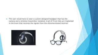 Bionic eye | PPTX