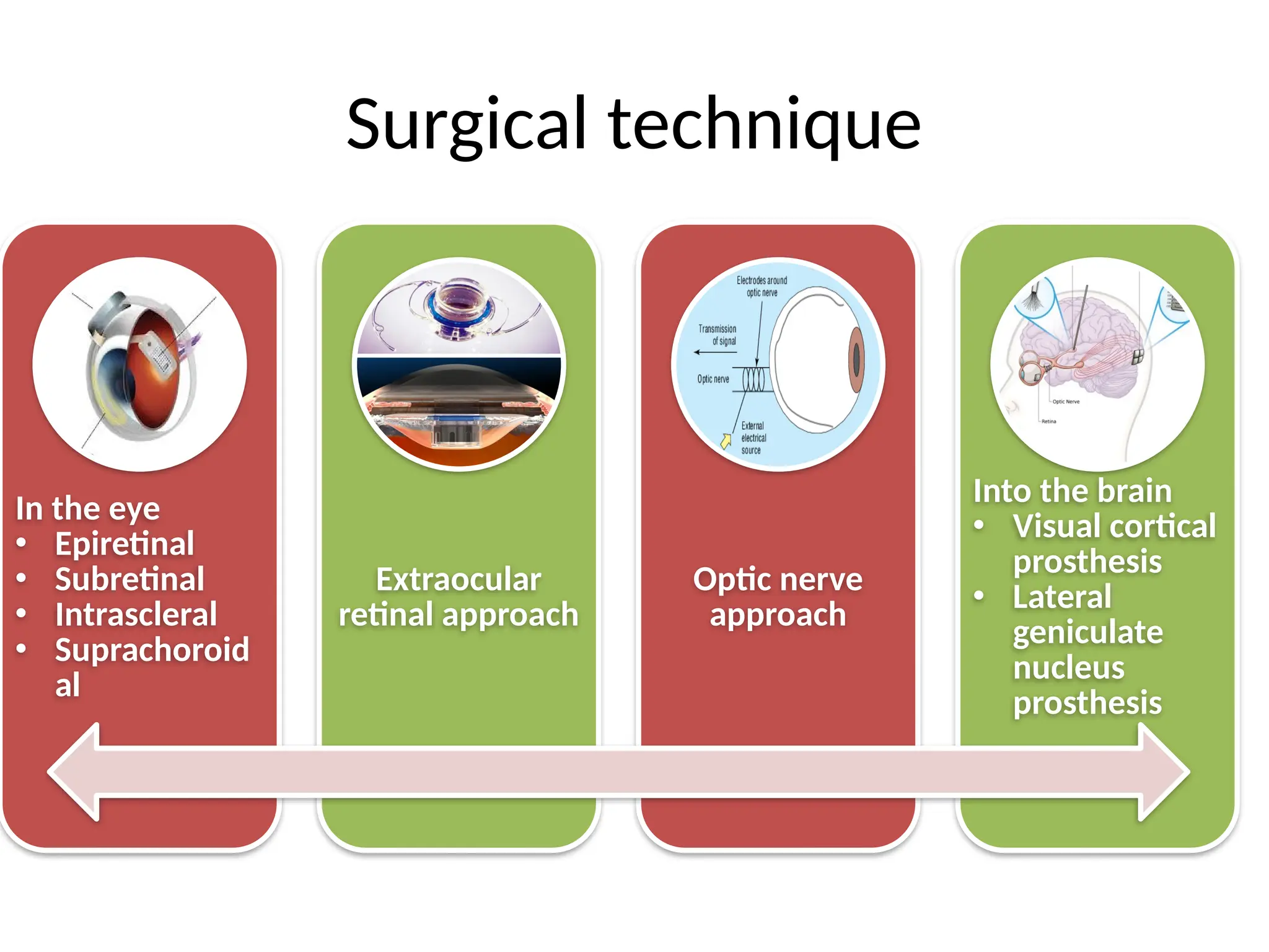 artificial eye ( bionic eye, MARC, epiretinal prosthesis, etc.).pptx
