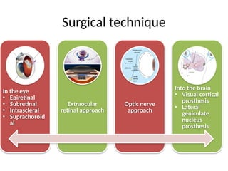 artificial eye ( bionic eye, MARC, epiretinal prosthesis, etc.).pptx