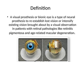 artificial eye ( bionic eye, MARC, epiretinal prosthesis, etc.).pptx