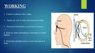artificial eye ppt. | PDF