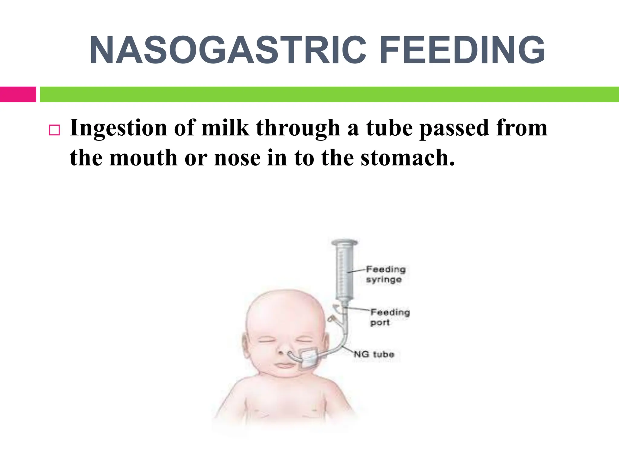ARTIFICIAL FEEDING (2) child health nursing | PPTX