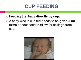 ARTIFICIAL FEEDING (2) child health nursing | PPTX