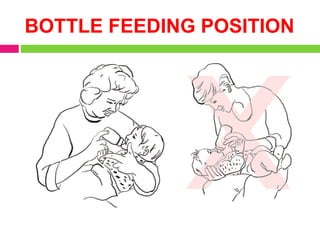ARTIFICIAL FEEDING (2) child health nursing | PPTX