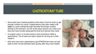 Artificial feeding of the patient | PPTX