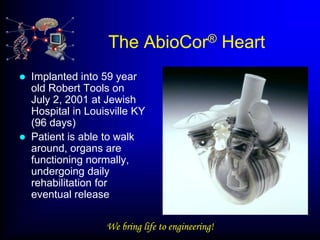 Abiocor Artificial Heart
