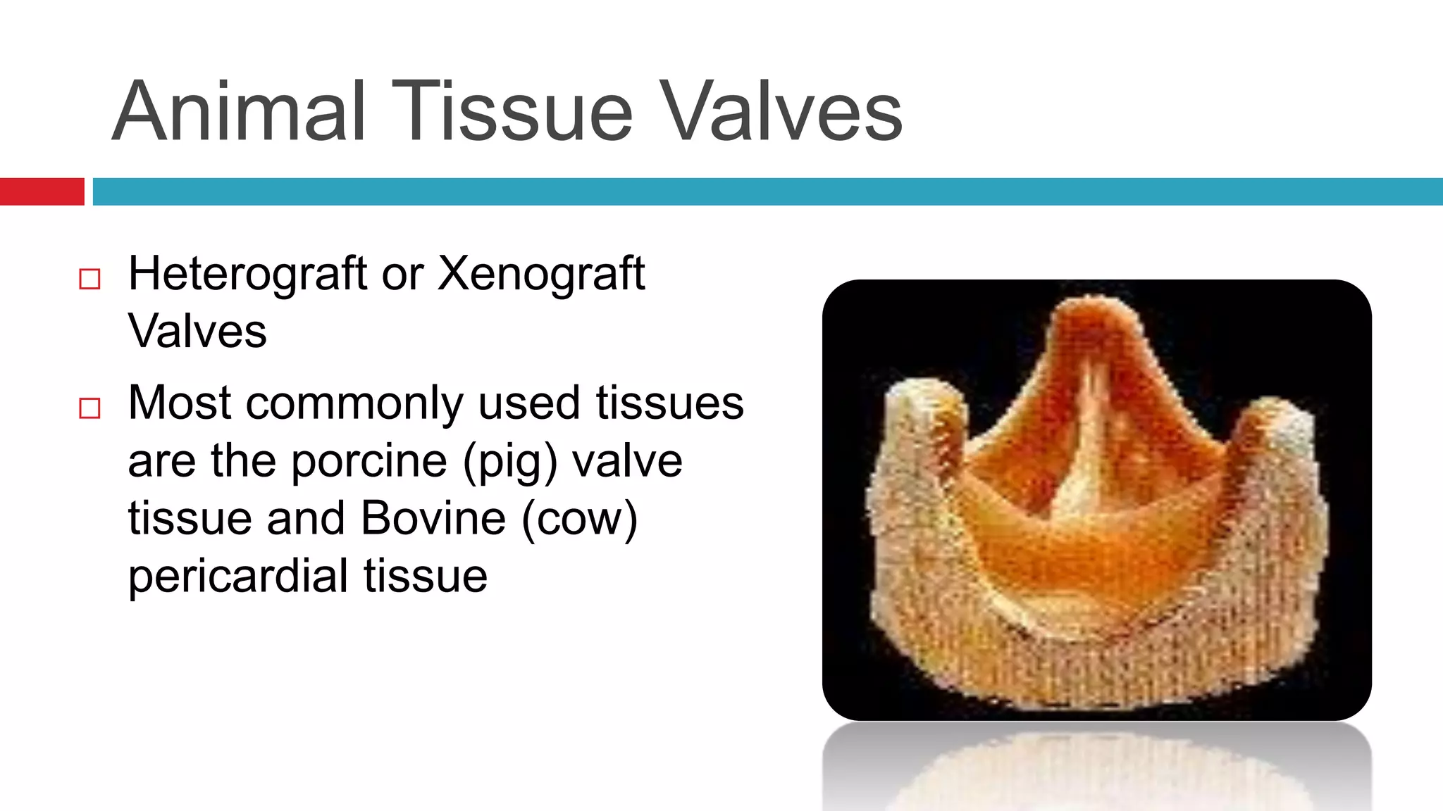 Artificial heart | PPTX