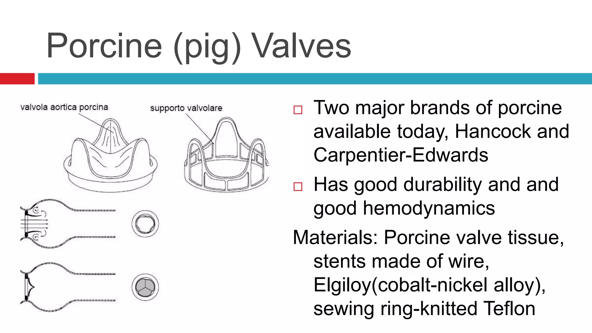 Artificial heart | PPTX