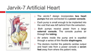 Artificial heart | PPTX