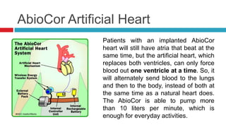 Artificial heart | PPTX