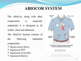 artificial heart.pptx