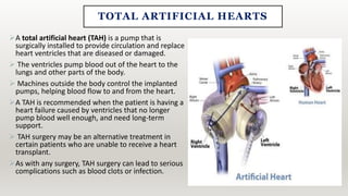 Artificial heart.pptx