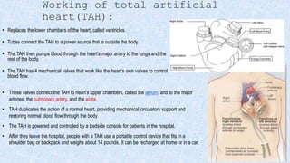 Artificial heart.pptx