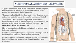 Artificial heart.pptx