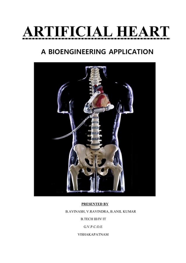Artificial heart | PDF
