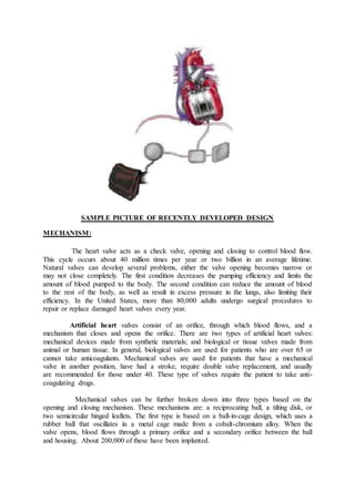 Artificial heart | DOC