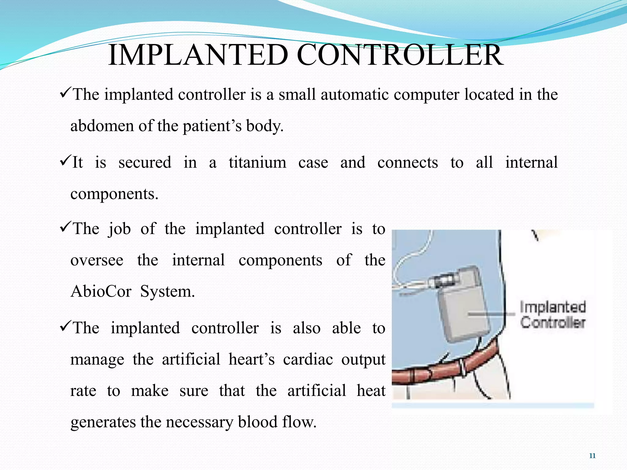 Artificial heart ppt | PPTX