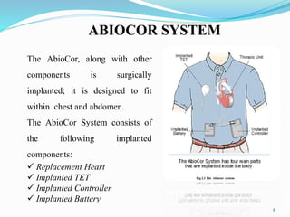 Artificial heart ppt | PPTX