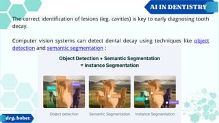 Artificial in Dentistry-drg.bobet.pptx