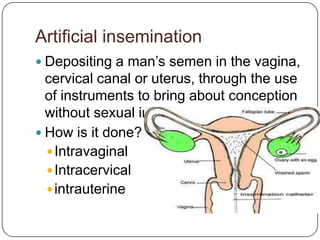 Artificial insemination | PPTX