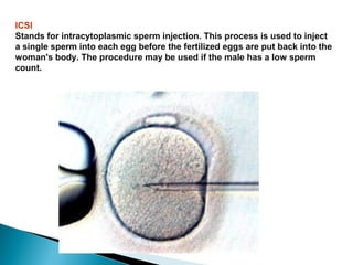 Artificial insemination | PPT