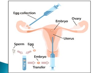 Human Artificial Insemination