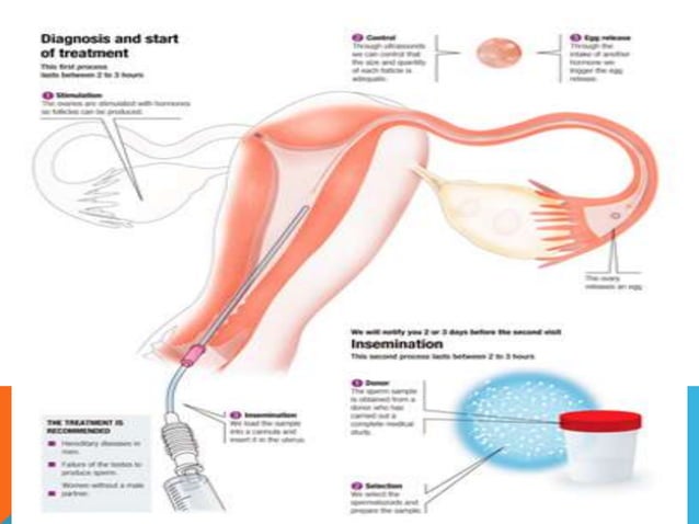 Artificial insemination by Binela Bhattarai | PPT
